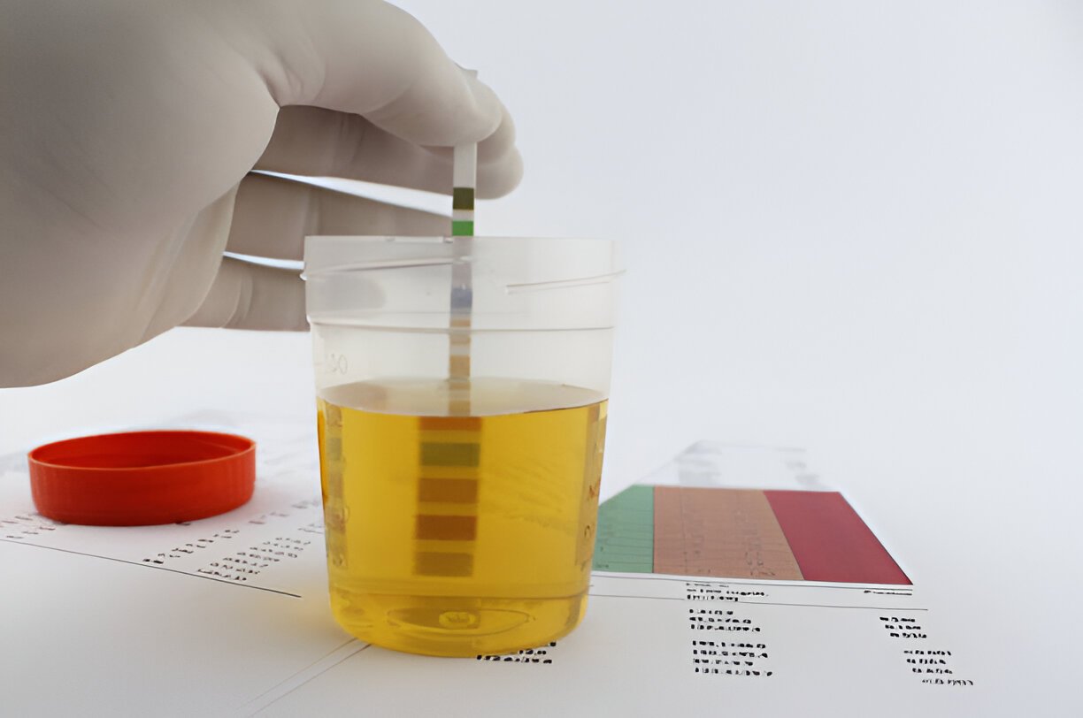 How Far Back Does a Urine Drug Screen Test Detect?